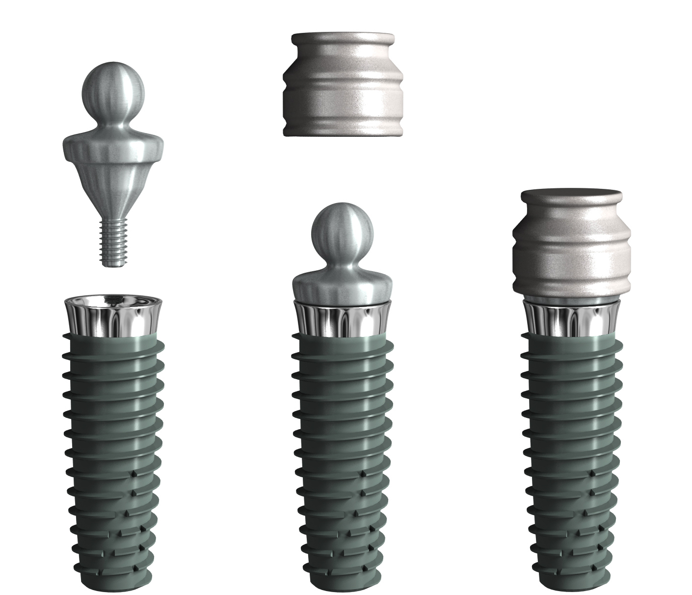 Was kosten Locator Prothesen und Kugelkopfimplantate?
